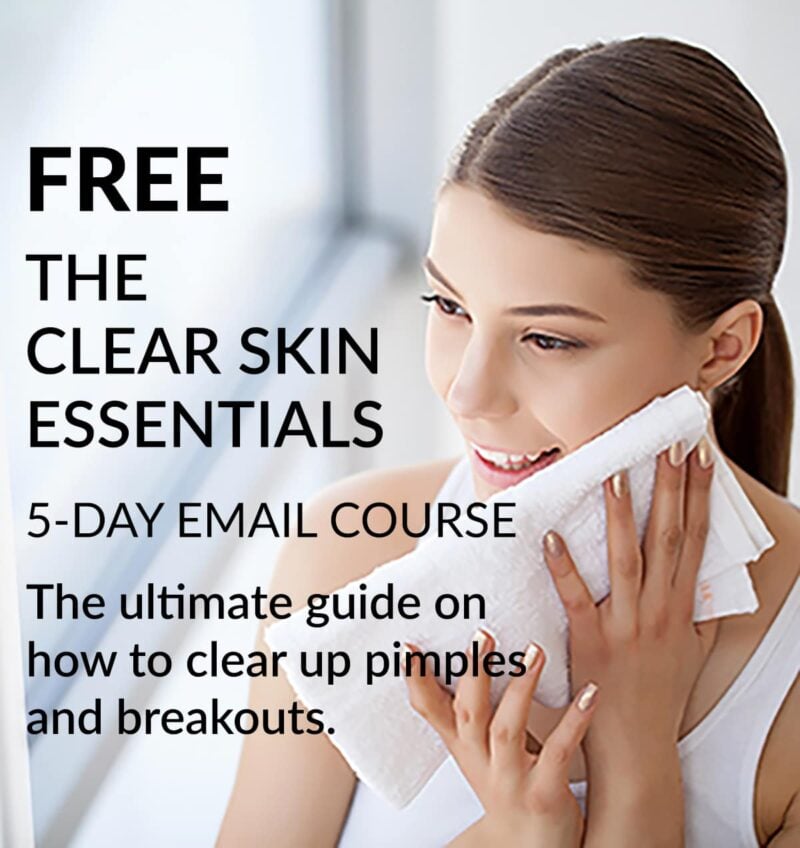 Skin Purging vs. Breakout (How To Tell The Difference) - Inspire Beauty